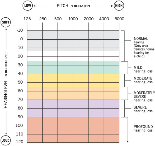 Audiogram Creator now supports bone conduction, air masked and bone ...